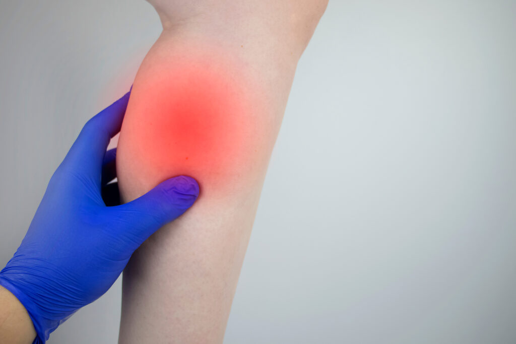 Leg Spasm Treatment—Symptoms, Risks & Care Explained