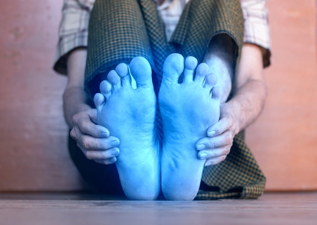 Poor Circulation to Feet: Causes, Symptoms, and Treatments - Wellness ...