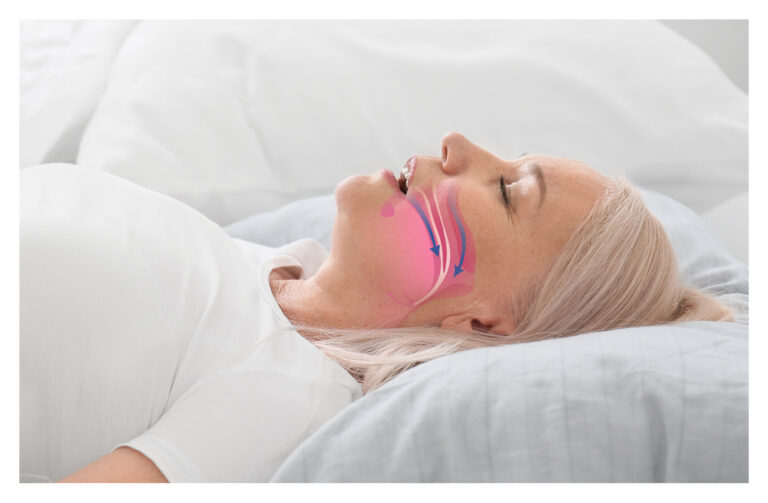 HST Test, the ‘First Night Effect,’ and Sleep Apnea - Wellness and Pain